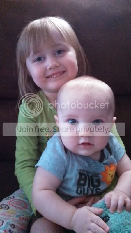 Strange ridge on forehead | BabyCenter